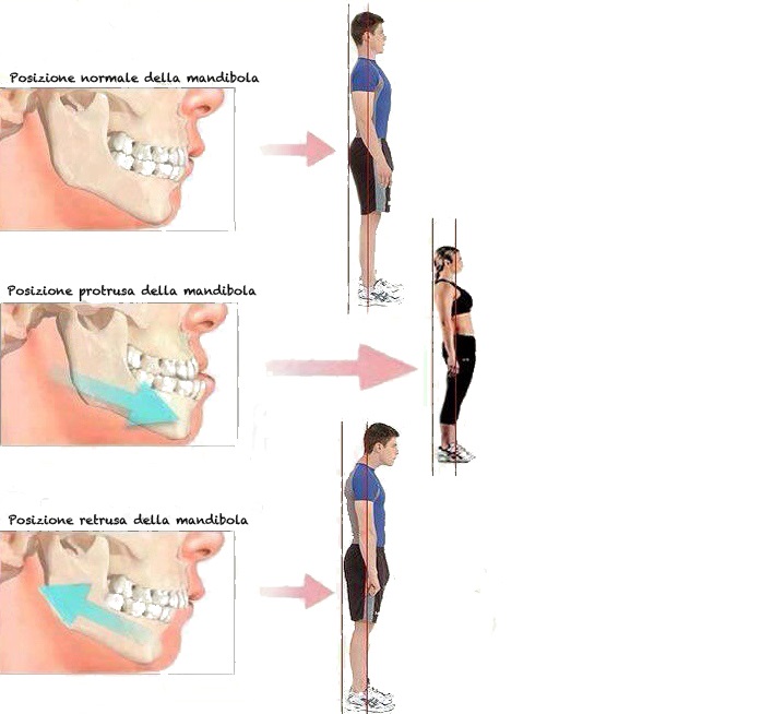 OCCLUSIONE E POSTURA | STUDIO DENTISTICO